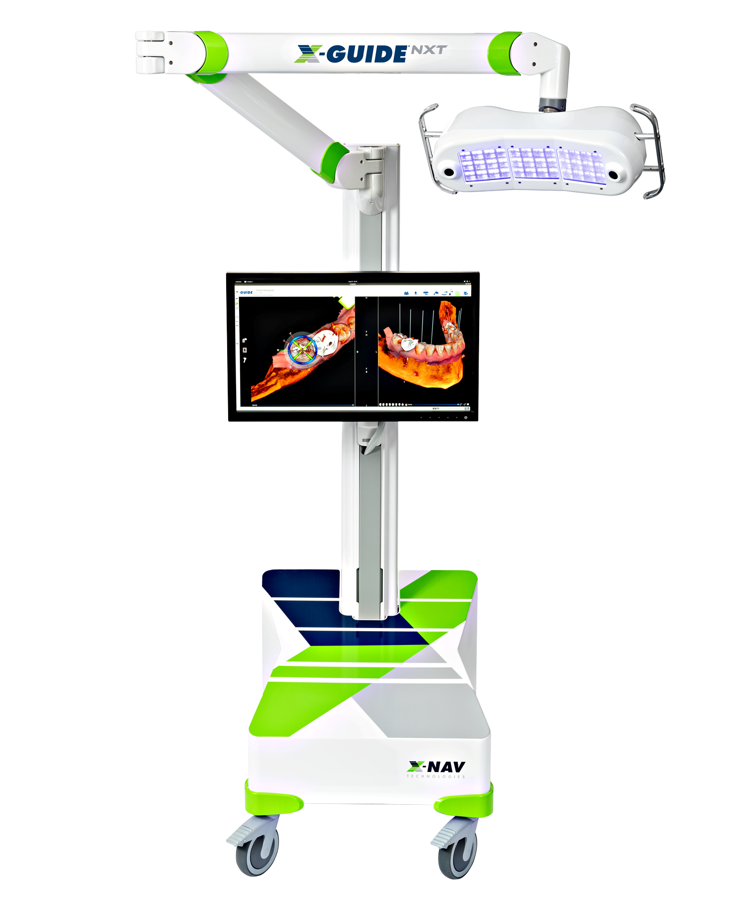 Xガイド - いそべ歯科医院 ｜山口県柳井市の歯医者なら、日本口腔インプラント学会専門医・指導医も在籍の、いそべ歯科医院